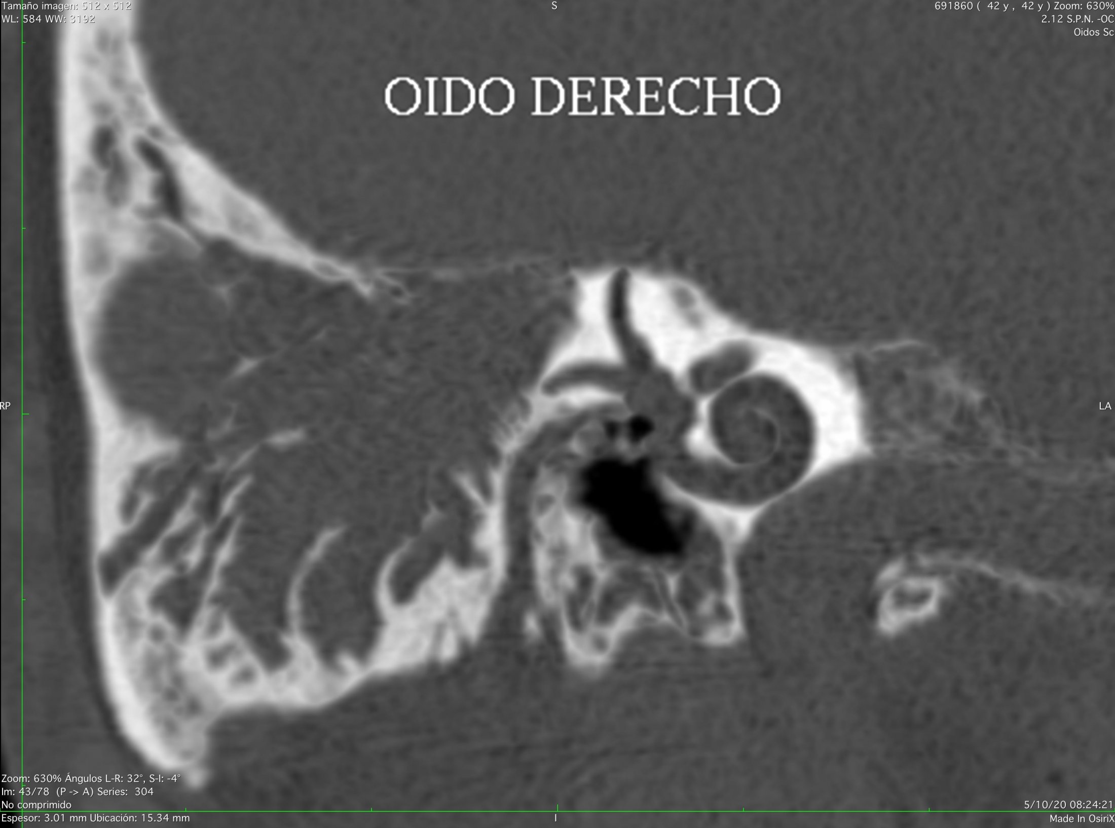 Tomografía – VAFOBOL